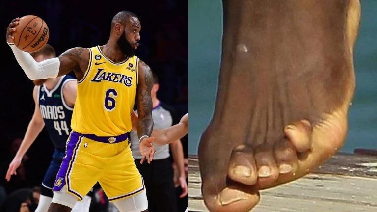 LeBron James Toes: Does the King Need Toe Surgery? Have His Signature ...