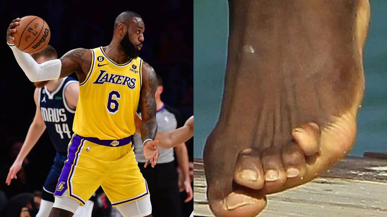 LeBron James Toes: Does the King Need Toe Surgery? Have His Signature ...