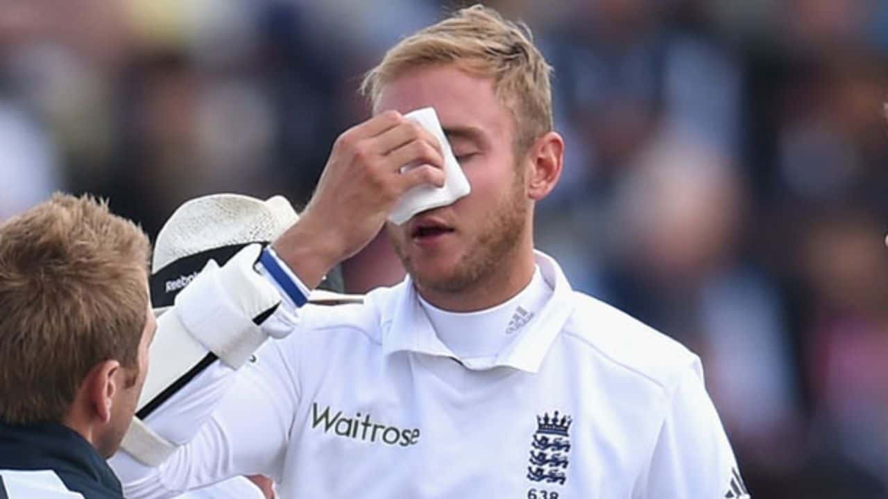 Stuart Broad Broken Nose: What Really Happened During England-India Old ...