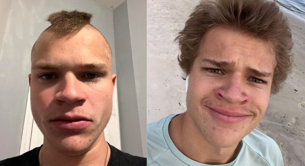 Jynxzi Twitch Archives - The SportsRush